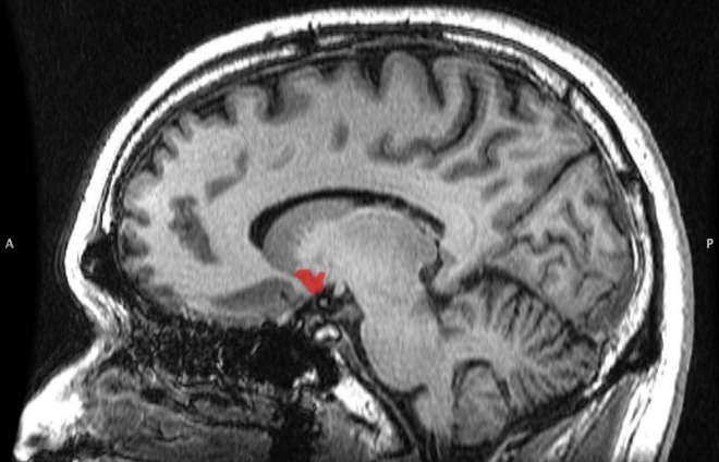 Brain's Reward Center Does More Than Manage Rewards - Pacific Standard