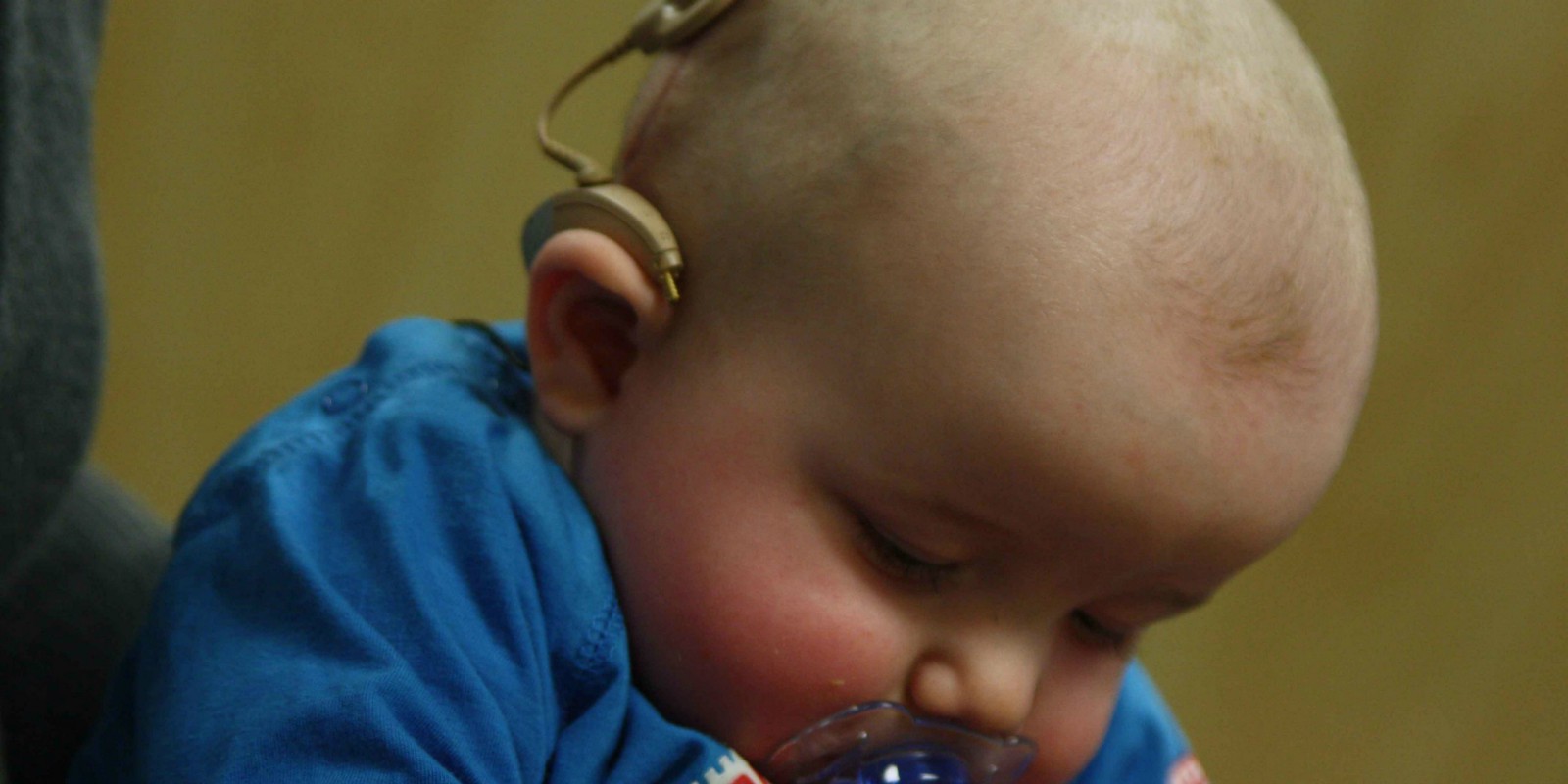 Do Deaf Babies Need to Be Fixed?
