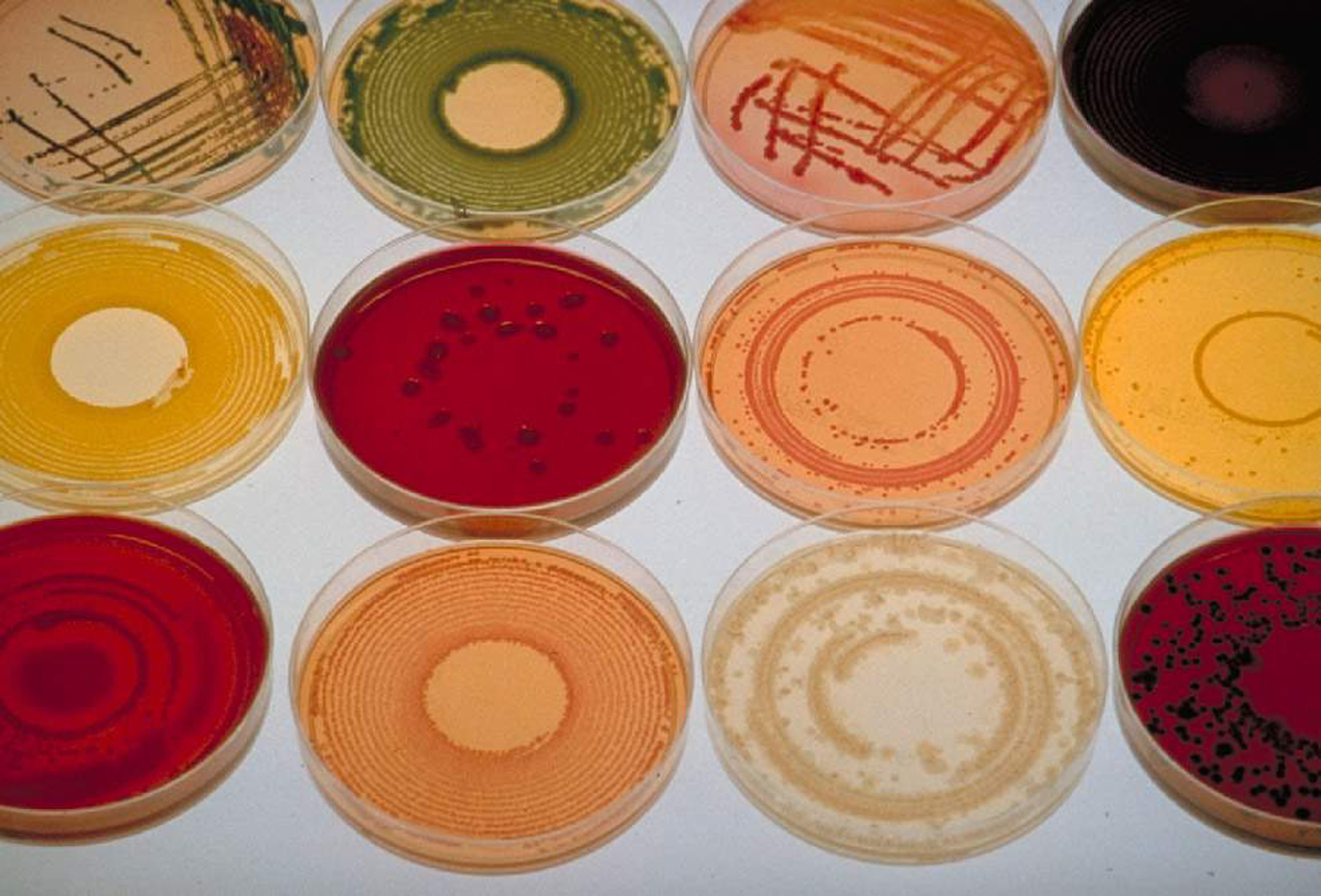 Manipulating Microbes May Be a Key to the Future of Restorative Health