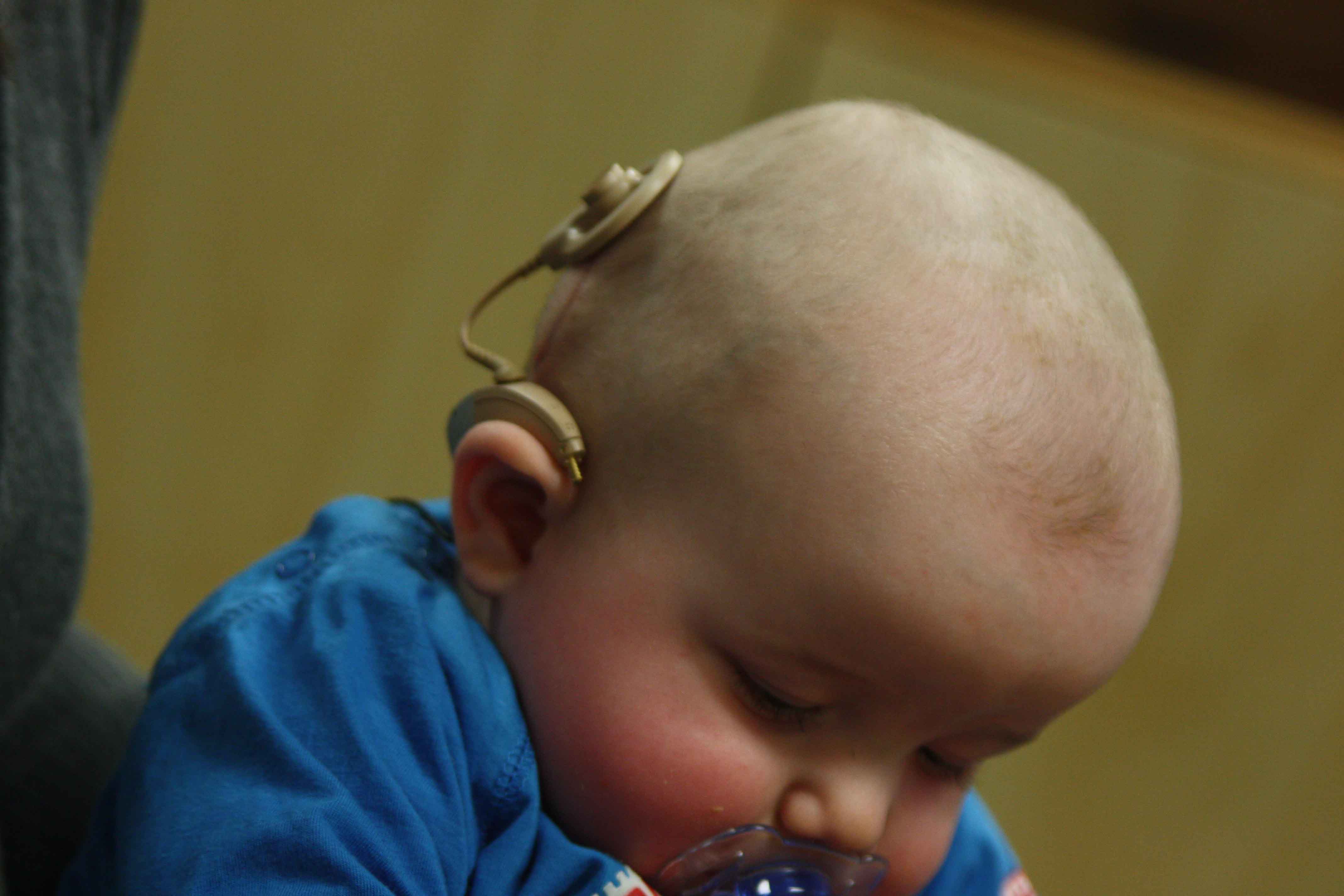 When Deafness Is Medicalized: Inside the Culture Clash Over Cochlear ...